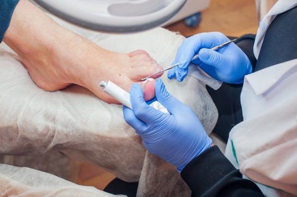 About Podiatry | Podiatry Services| Bucks Foot Clinic