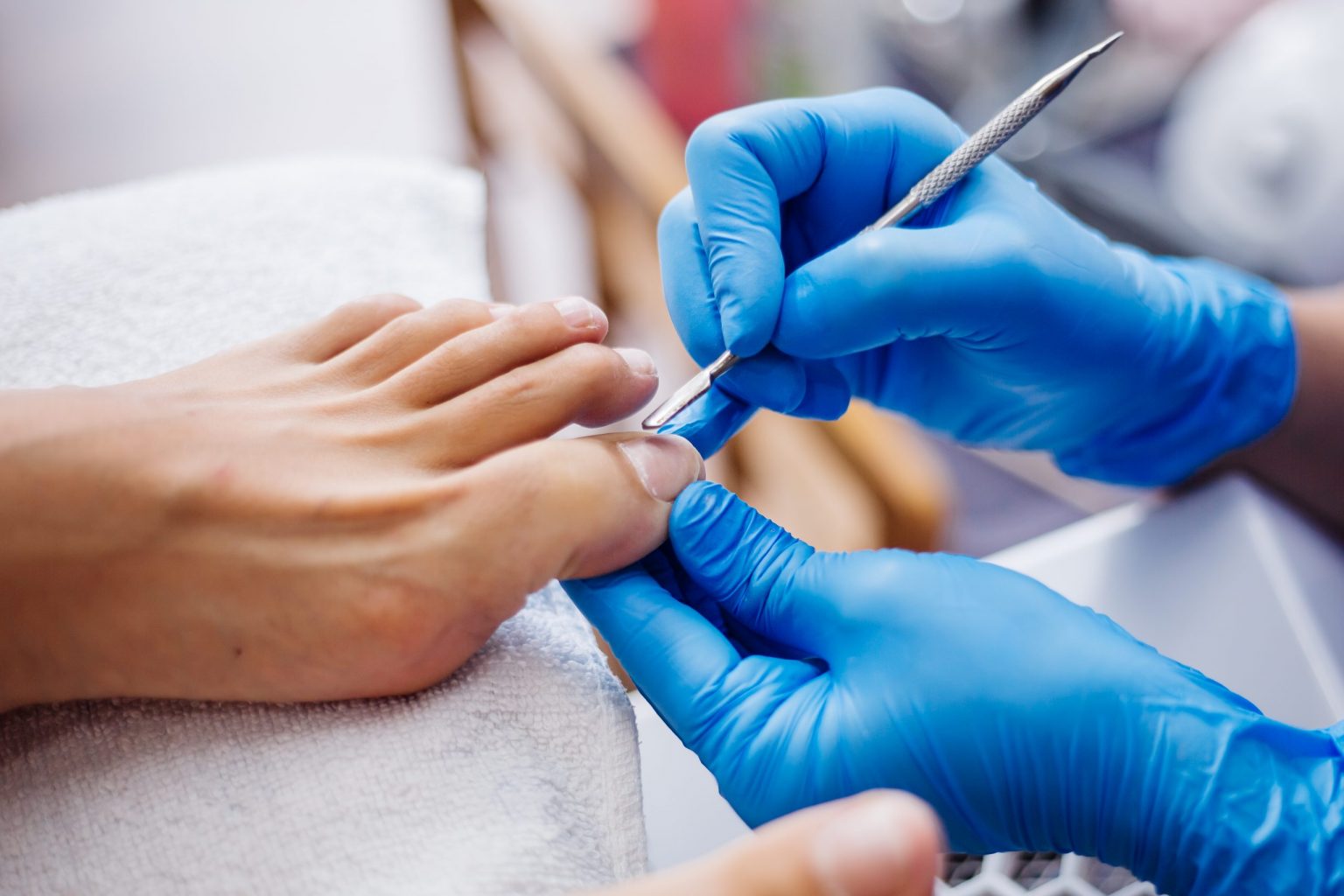 What’s It Like Dealing with Ingrown or Fungal Toenails?