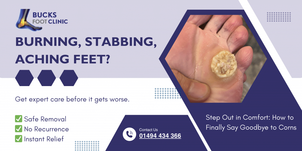 How Podiatrists Can Help with Corns: Relief, Treatment Prevention