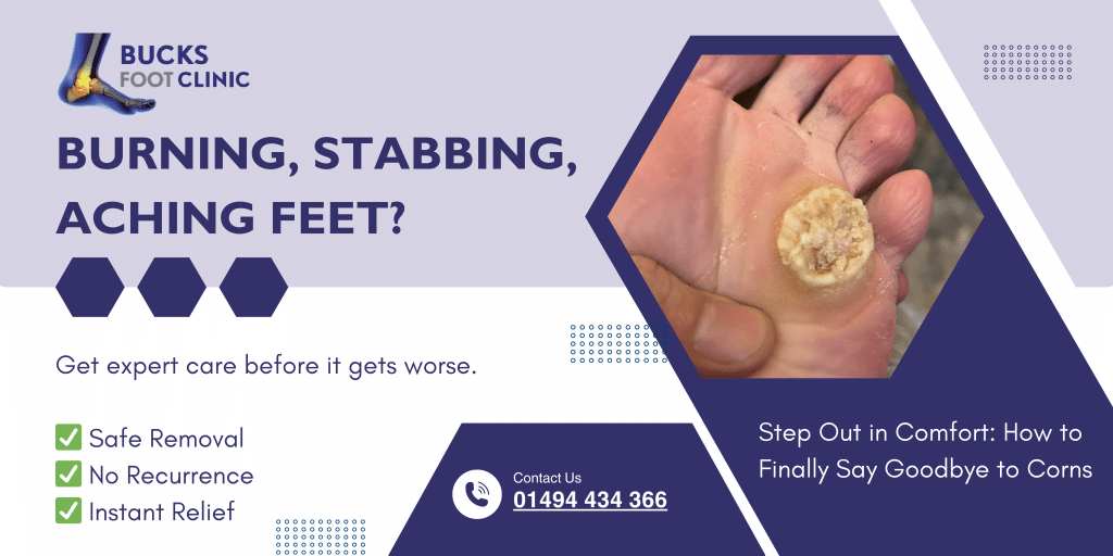 How Podiatrists Can Help with Corns: Relief, Treatment Prevention