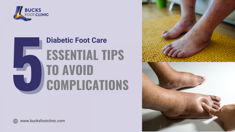 Diabetic Foot Care: 5 Essential Tips to Avoid Complications