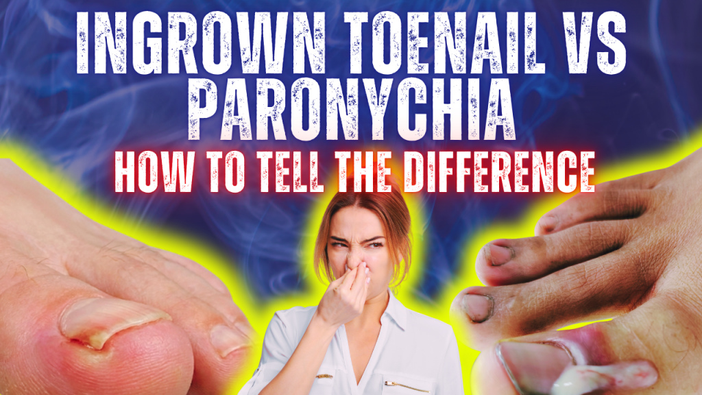 Ingrown Toenail vs Paronychia: How to Tell the Difference
